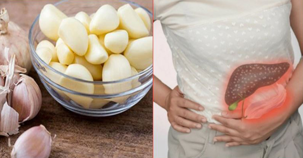 Garlic is healthy - Not good for everyone (6 groups shouldn't)