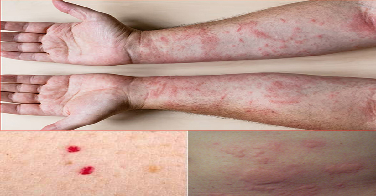 If You Spot These Red Dots On Your Skin You Had Better Know What They