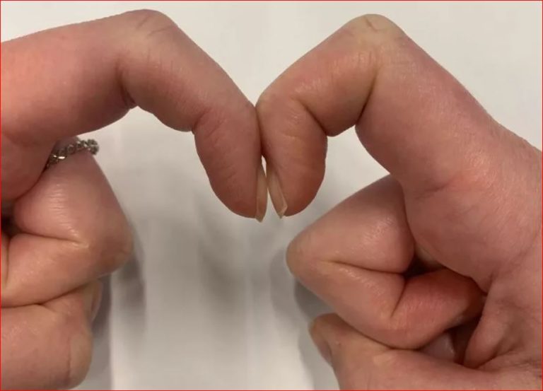 This quick 'finger test' could help save your life - Wake Up Your Mind