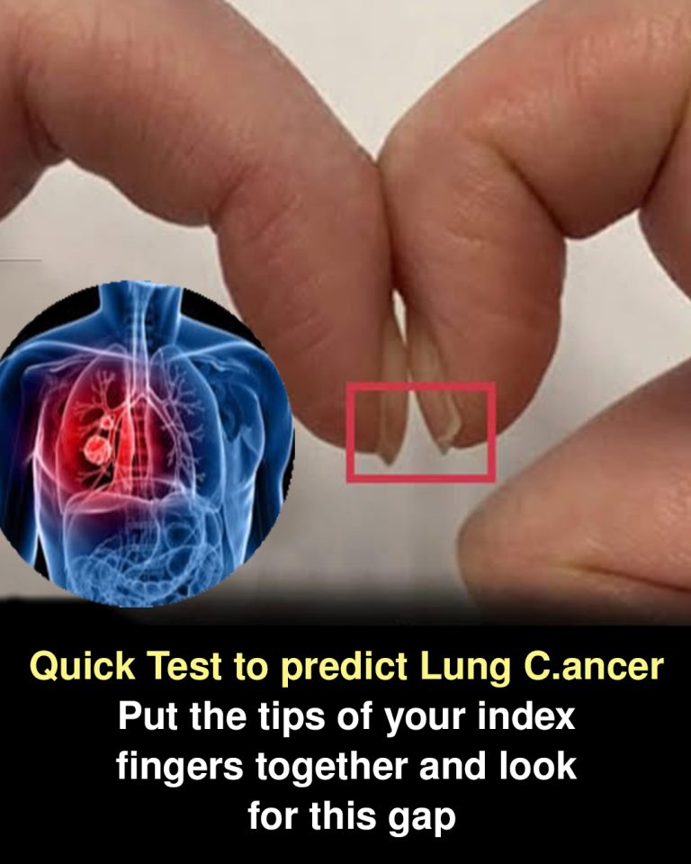 This quick 'finger test' could help save your life - Wake Up Your Mind