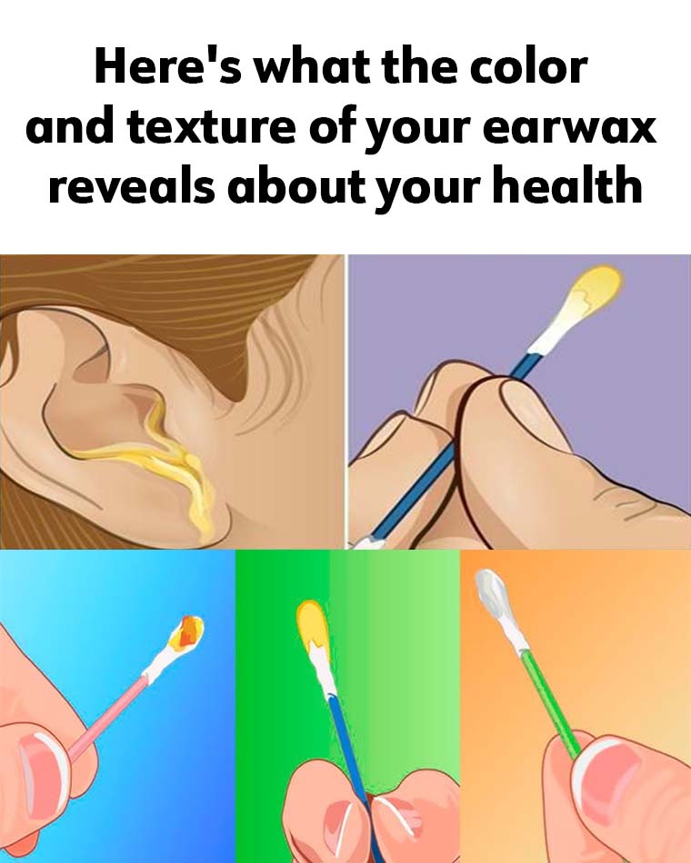 The Color And Texture Of Your Earwax Reveals Everything About Your H.ealth - Wake Up Your Mind