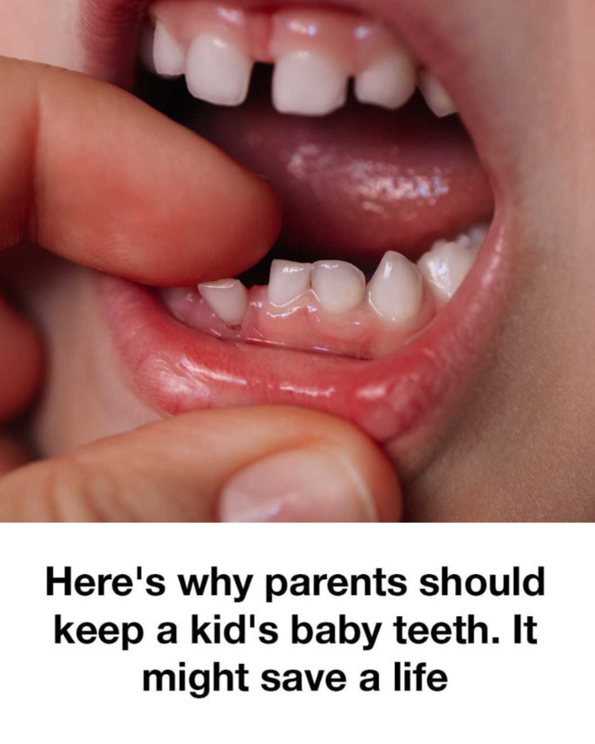 Here's why parents should keep a kid's baby teeth. It might save a life