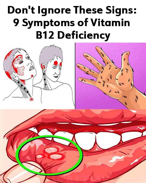 9 symptoms of vitamin B12 deficiency you should never ignore - Wake Up ...