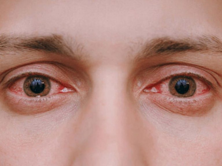 10 Signals Your Thyroid Is Not Functioning Properly - Wake Up Your Mind